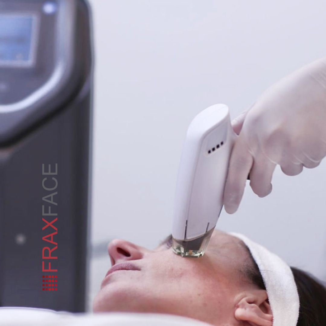 FraxFace - Divali Clinic